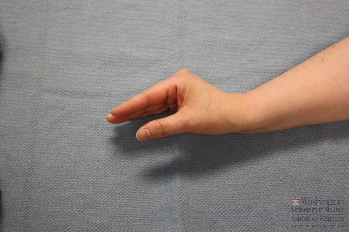 Lumbricals muscle :- Samarpan Physiotherapy Clinic Ahmedabad